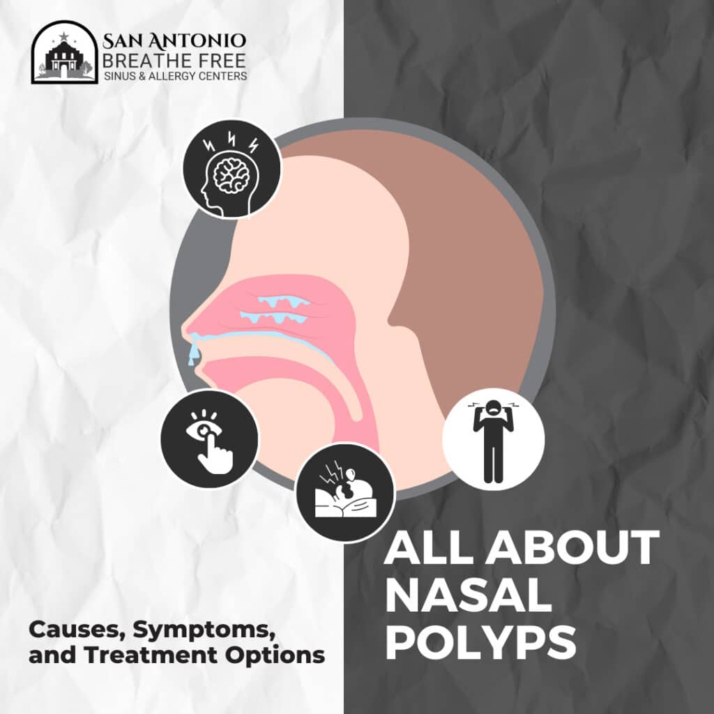 All About Nasal Polyps: Causes, Symptoms, and Treatment Options in San ...